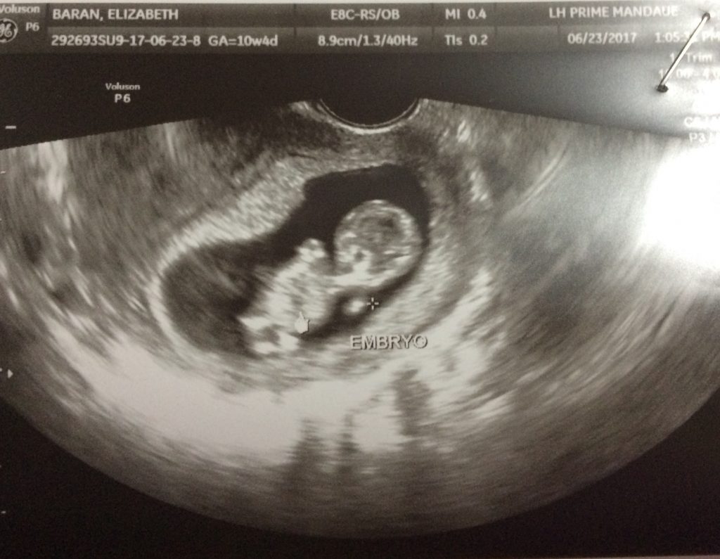 Announcing… | The Baran Family